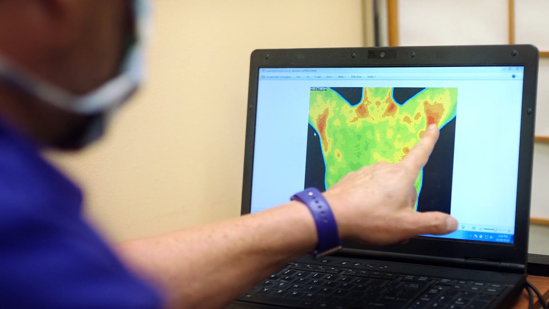 Thermography - Narberth Family Medicine & Acupuncture Center